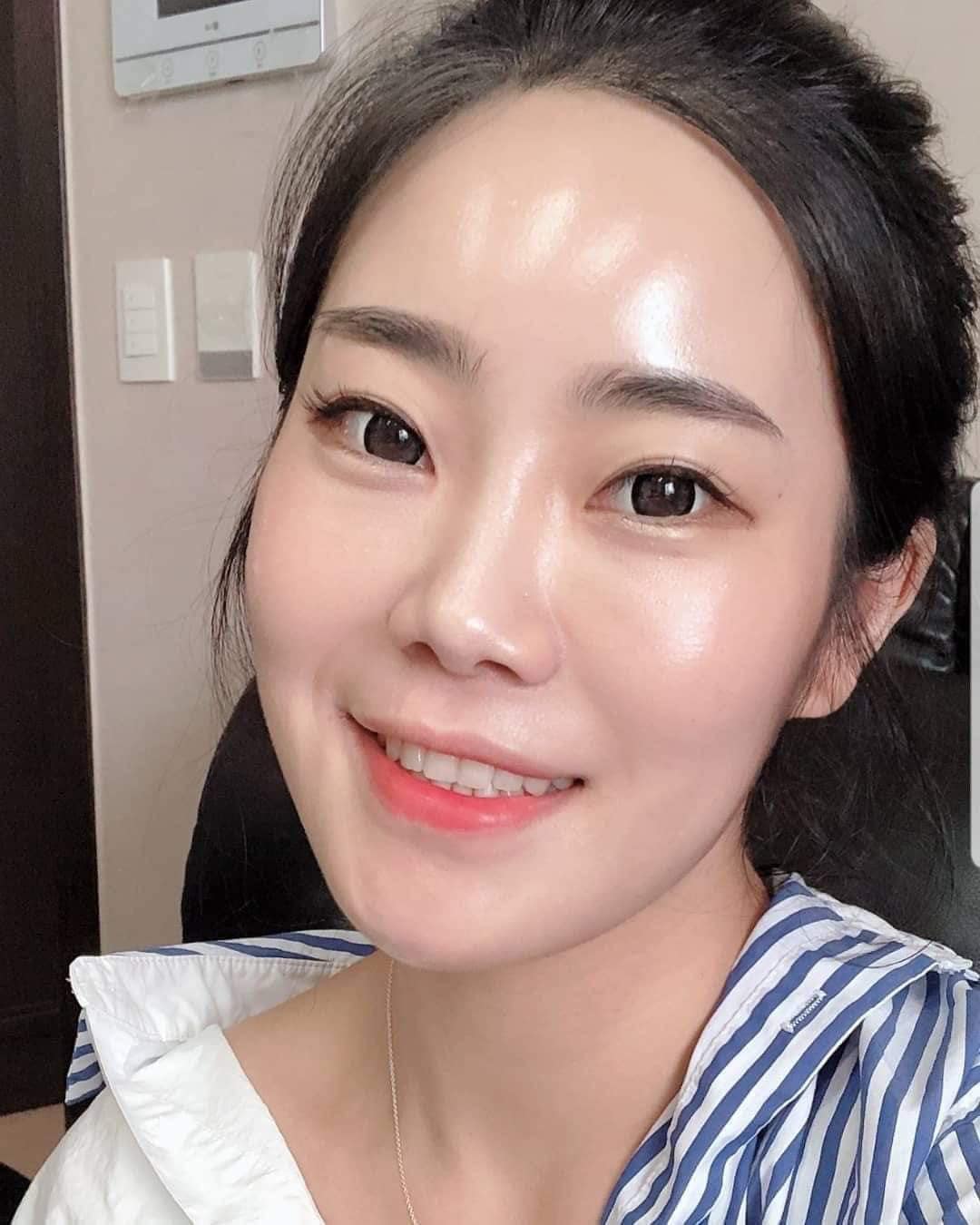 [GIÁ TỐT] Kem B5 Mq Skin - Recovery Cream Dưỡng Trắng Da